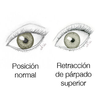 R TRACTION PALP BRALE Dr Marco Sales R TRACTION PALP BRALE Dr Marco Sales