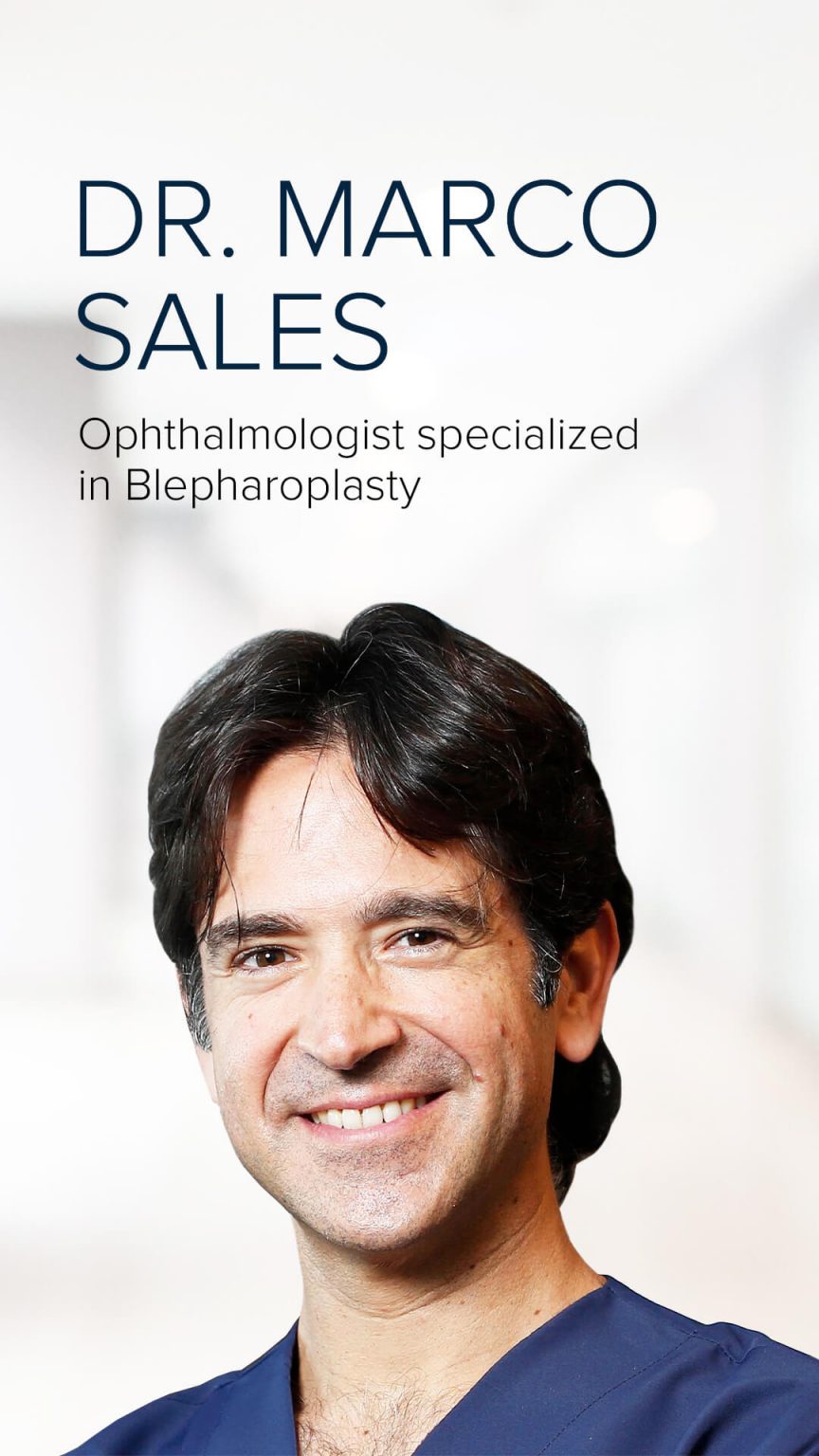 Dr. Marco Sales - Ophthalmologist specialized in Blepharoplasty in Madrid